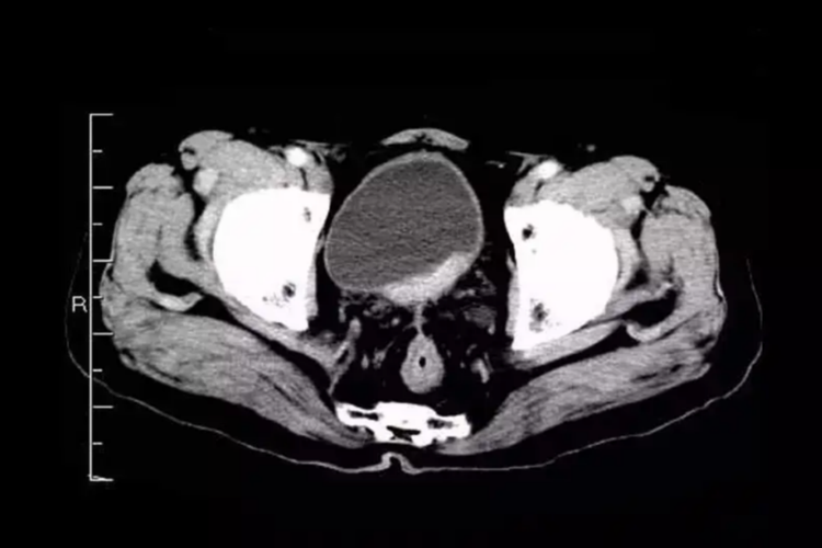 下腹部CT都是检查什么部位