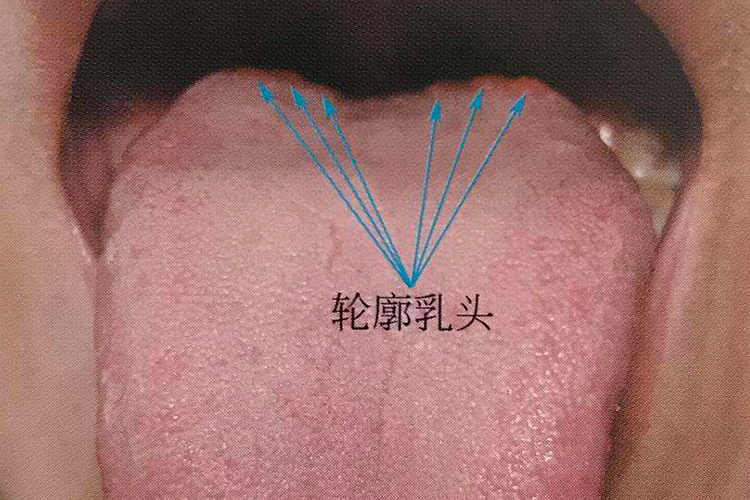 舌头靠近喉咙处有小疙瘩图片