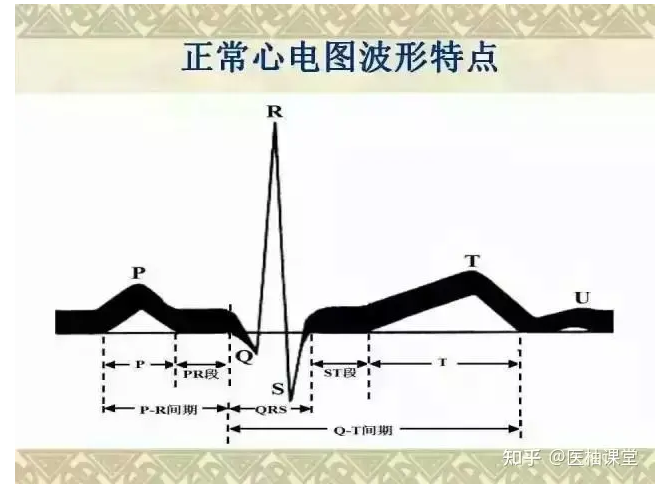 心电图ecg是什么意思