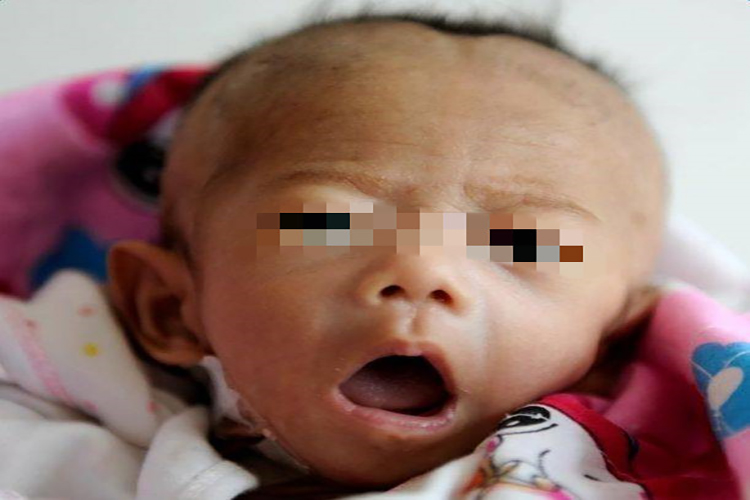 宝宝有疳积的图片