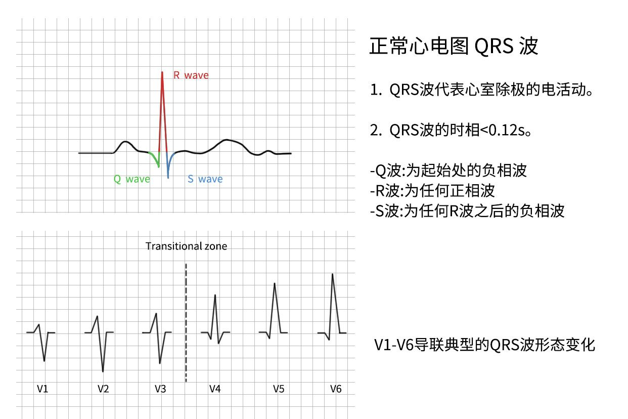 心电图qs波代表什么 | 百度健康·医学科普