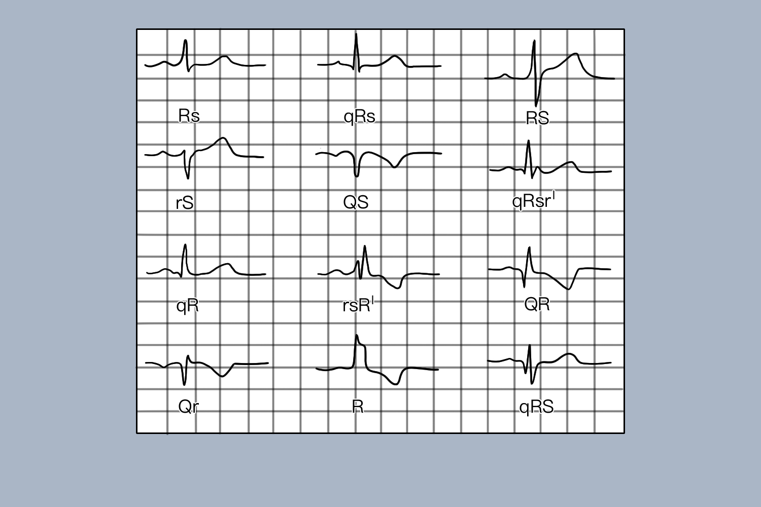 qrs波各种形态图